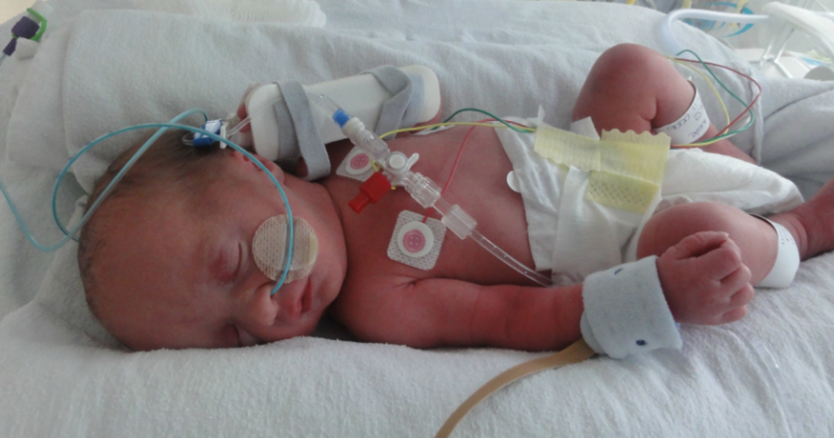 AFN - Debate over Born-Alive bill brings out bizarre defense of abortion